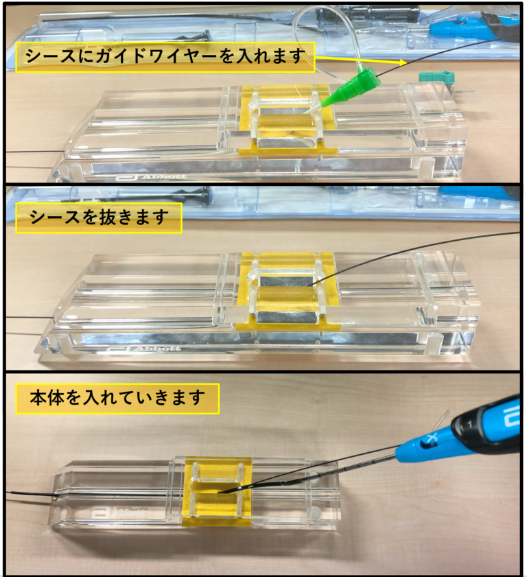 Perclose prostyleのシュミレーション｜脳神経外科 つれづれ